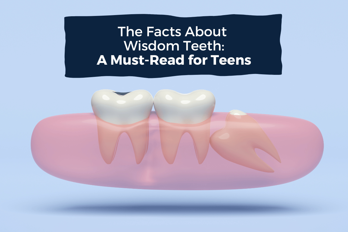 The Facts About Wisdom Teeth: A Must-Read for Teens - Lafayette ...