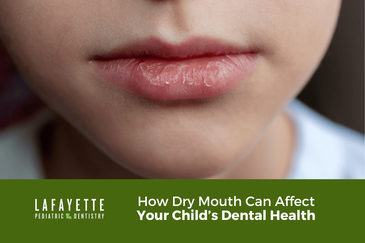 How Dry Mouth Can Affect Your Child’s Dental Health - Lafayette ...