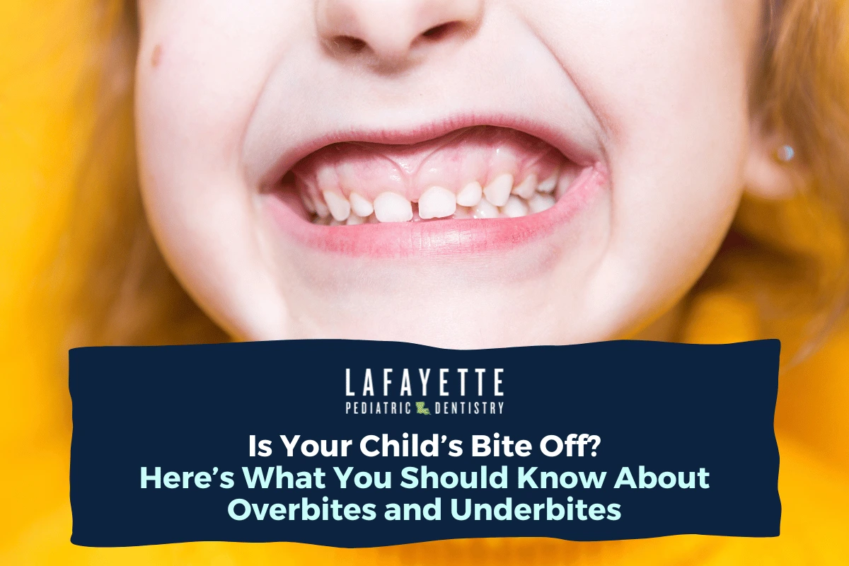 Is Your Child’s Bite Off? Here’s What You Should Know About Overbites ...