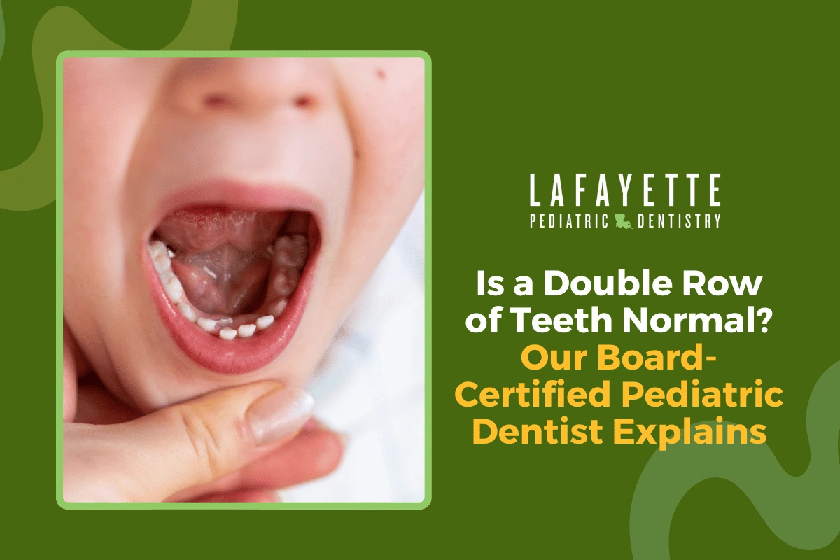 Is a Double Row of Teeth Normal? Our Board-Certified Pediatric Dentist ...