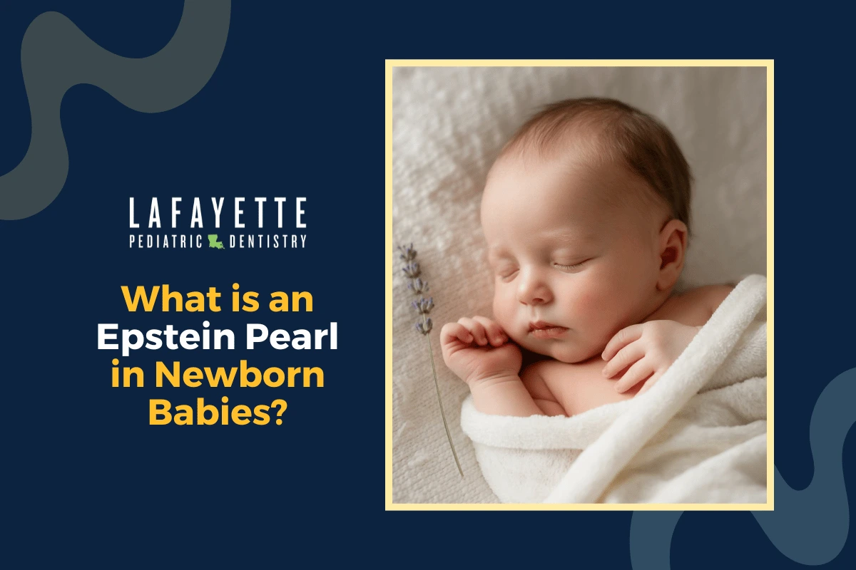 What is an Epstein Pearl in Newborn Babies? - Lafayette Pediatric Dentistry